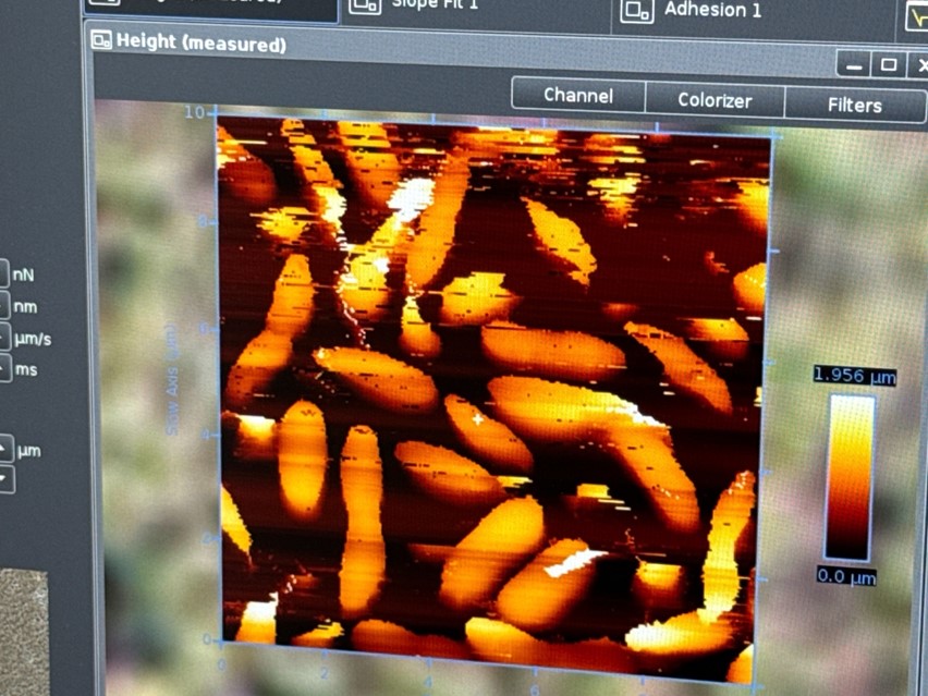 Are Bacteria ‘Bumps’ Changing the Future of Marine Nutrients ...