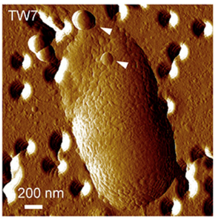 Are Bacteria ‘Bumps’ Changing the Future of Marine Nutrients ...